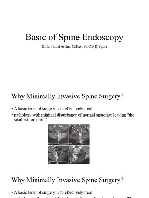 Basic Of Spine Endoscopy Fixed Pdf