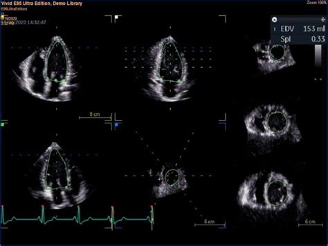 Lv Systolic Functionpptx 3 D Graphics Computer Software And Applications