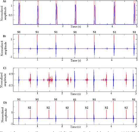 figure 4 from automatic segmentation and classification of heart sounds