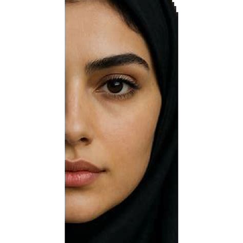 بلفاروپلاستی پلک بالا یا جراحی پلک بالا ← نمونه کار قبل و بعد مهر 1404