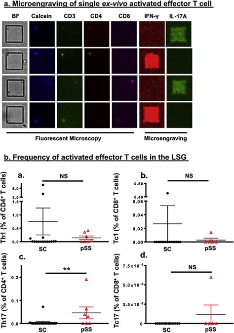 Unique Glandular Ex Vivo Th1 And Th17 Receptor Motifs In Sjögrens