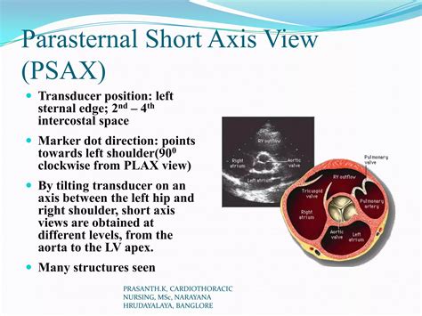 Echocardiogram Basics Ppsx