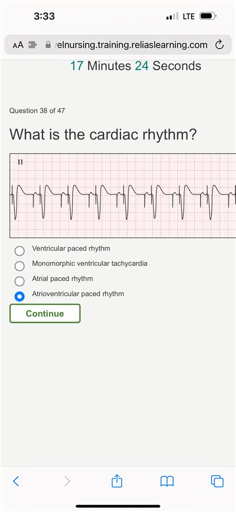 Solved What Is The Cardiac Rhythmventricular Paced