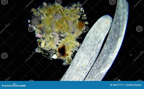 Spirostomum Under Microscope