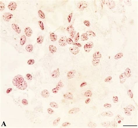Somatic Cells From The Testicular Peritoneal Sheath Of Hybrids Note Download Scientific