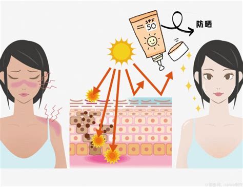 多形性日光疹怎么办？ 哔哩哔哩