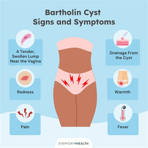 Bartholins Cyst
