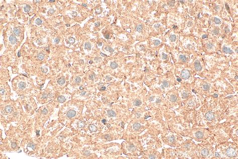 Cyp8b1 Antibody 55217 1 Ap Proteintech 武汉三鹰生物技术有限公司
