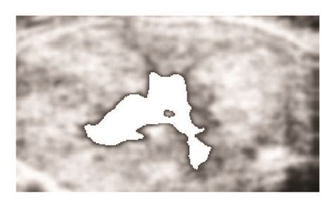 Segmented Area Using Region Growing Download Scientific Diagram