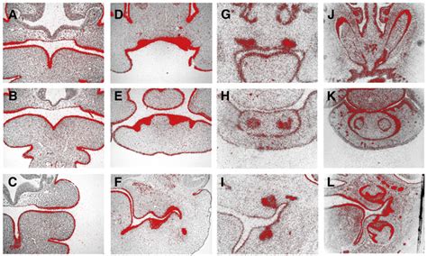 The Role Of Irf6 In Tooth Epithelial Invagination Abstract Europe Pmc