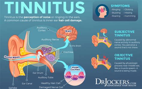 The Role Of Audiologists In Evaluating Hearing Loss And Tinnitus