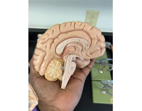 Diencephalon Structures Quiz