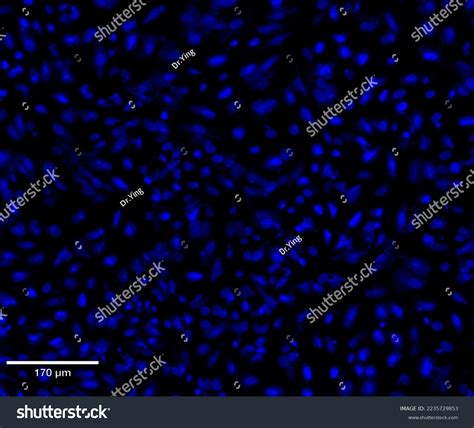 Immunofluorescence Staining Use Research Laboratory Including Stock Photo 2235729853 Shutterstock