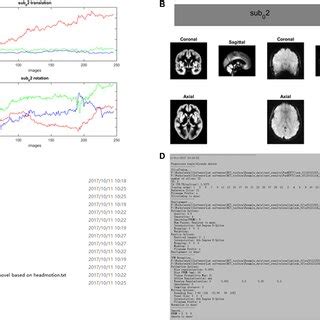 PDF Neuroscience Information Toolbox An Open Source Toolbox For EEGfMRI Multimodal Fusion