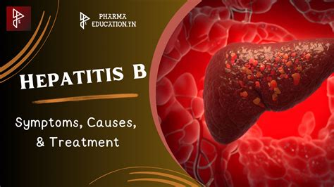 What Is Hepatitis B Signs And Symptoms Diagnosis Prevention And Treatment