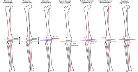 Various Alignment Techniques Download Scientific Diagram