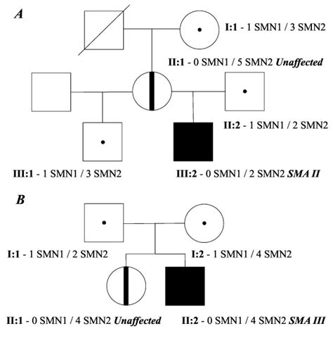 Pedigrees Of Spinal Muscular Atrophy Sma Families With Biallelic
