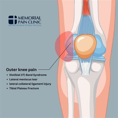 Knee Pain Location Chart Memorial Pain Clinic Tulsa Ok