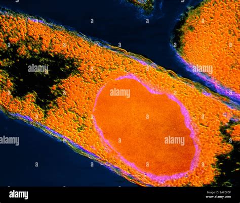 False Colour Transmission Electron Micrograph Tem Of The Bacterium Escherichia Coli