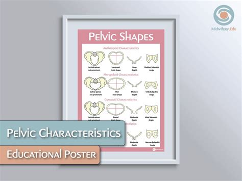 Pelvic Shape Educational Poster Etsy