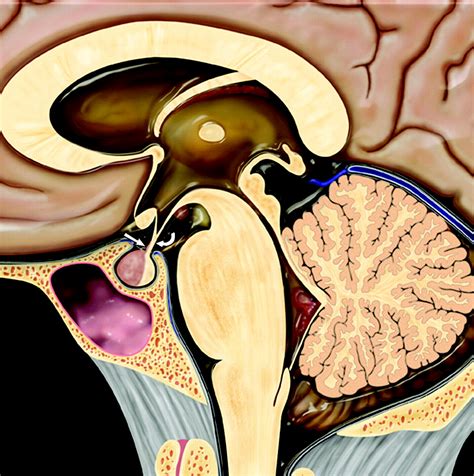 Infundibulum Brain
