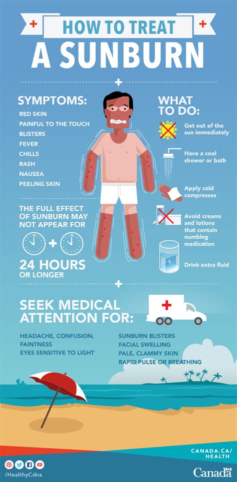 First Aid Advice For Sunburn And Heat Illness Canada Ca How To Stay