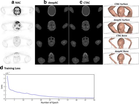 Example Of Pseudo Ct Image From Deepac Multiple Axial Slices From A