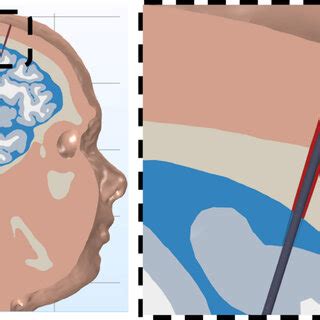 Schematic Representation Of The Electrode Geometries Used To Simulate Download Scientific