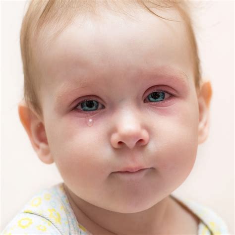 Apex Eye And Dental Hospital Pediatric Ophthalmology