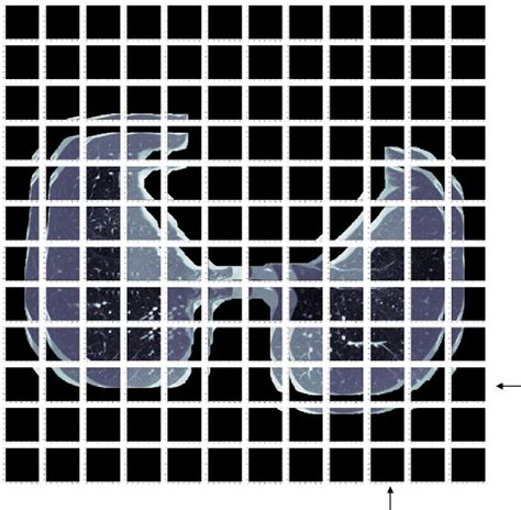 Figure 5 From Lung Nodule Detection By Using Deep Learning Semantic Scholar