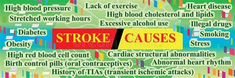 Derrame Cerebral Causa Muerte Cerebral Ilustración Del Vector Ilustración De Pista Arteria