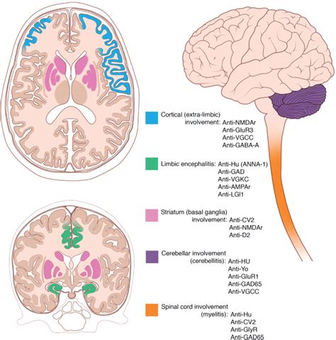 Autoimmune Encephalitis Clinical Tree