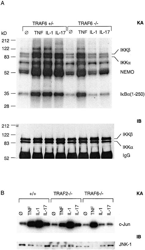 Kinase Activity Of The Ikk Complex And Jnk Isolated From Download