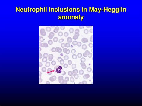 Ppt Afibrinogenemia Powerpoint Presentation Free Download Id689263