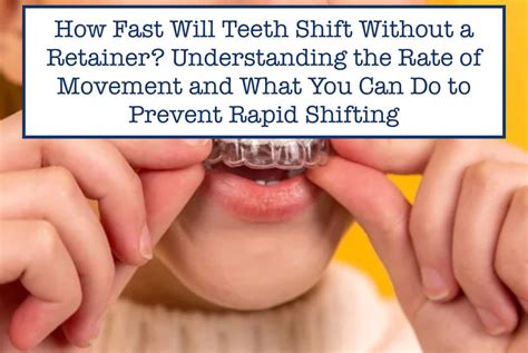 How Fast Will Teeth Shift Without Retainer Prevent Movement Now