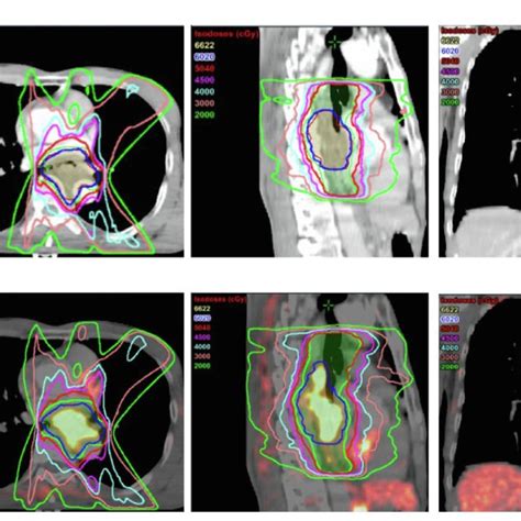 Haojun Chen Deputy Chief Physician Doctor Of Medicine Xiamen University Xiamen Xmu
