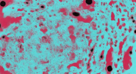 Multiphase Segmentation And Other Questions Usage And Issues Imagesc Forum