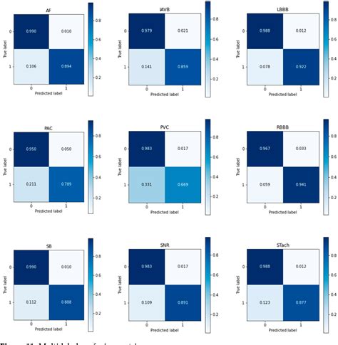 Figure 11 From Automatic Classification Method Of Arrhythmias Based On 12 Lead Electrocardiogram