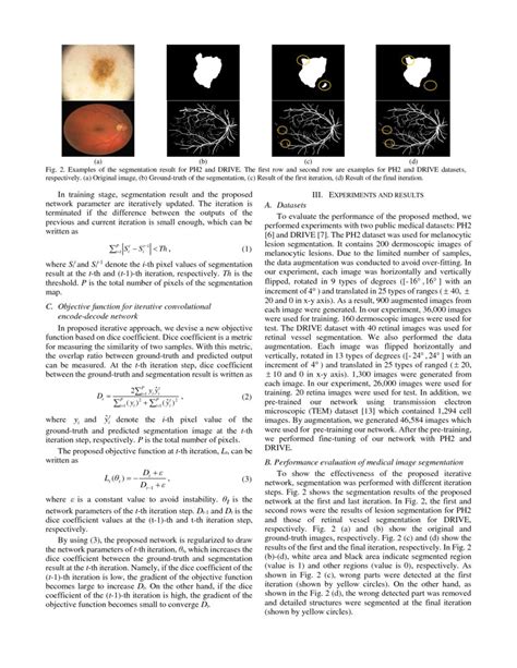 Iterative Deep Convolutional Encoder Decoder Network For Medical Image