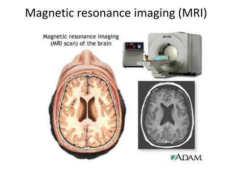 Ppt Lecture 1 Introduction To Psychophysics And Neuroimaging Ilan Dinstein Powerpoint