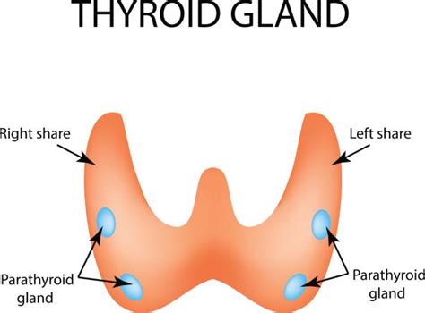 Hyperthyroidism Illustrations Royalty Free Vector Graphics And Clip Art