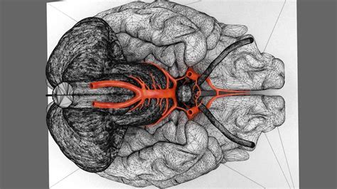 3d Circle Of Willis 3d Model Turbosquid 2046081