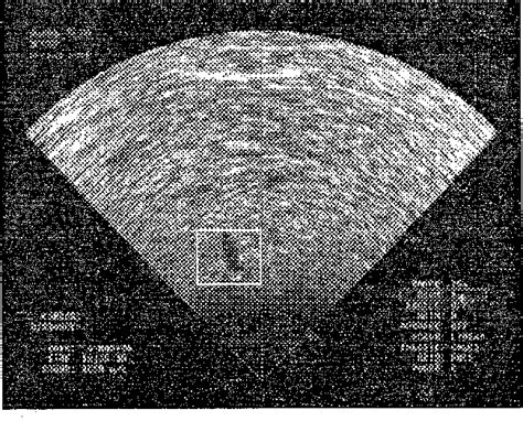 Figure 1 From Three Dimensional Reconstruction Of Underwater Objects From A Sequence Of Sonar
