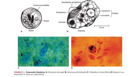 Amibiasis Trujano Tania UDocz