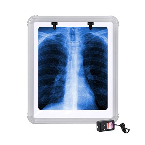 Digital X Ray Viewer Razzo Health Care