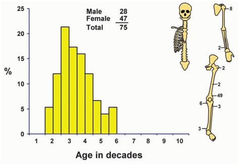 Parosteal Osteosarcoma Juxtacortical Osteosarcoma Musculoskeletal Key