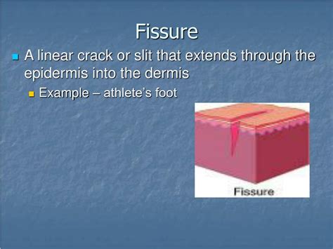 Ppt Chapter 3 Integumentary System Powerpoint Presentation Free