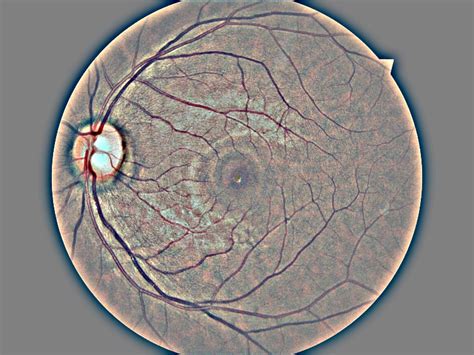 Image How To Convert Cv2addweighted And Cv2gaussianblur Into Matlab Stack Overflow