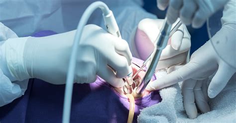 Man Mistakenly Gets Jaw Removed Instead Of His Wisdom Tooth Cyst • Philstar Life