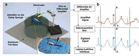 Github Jimmyz100ecg Data Analysis Files For The Signal Processing And Analysis Of Acquired